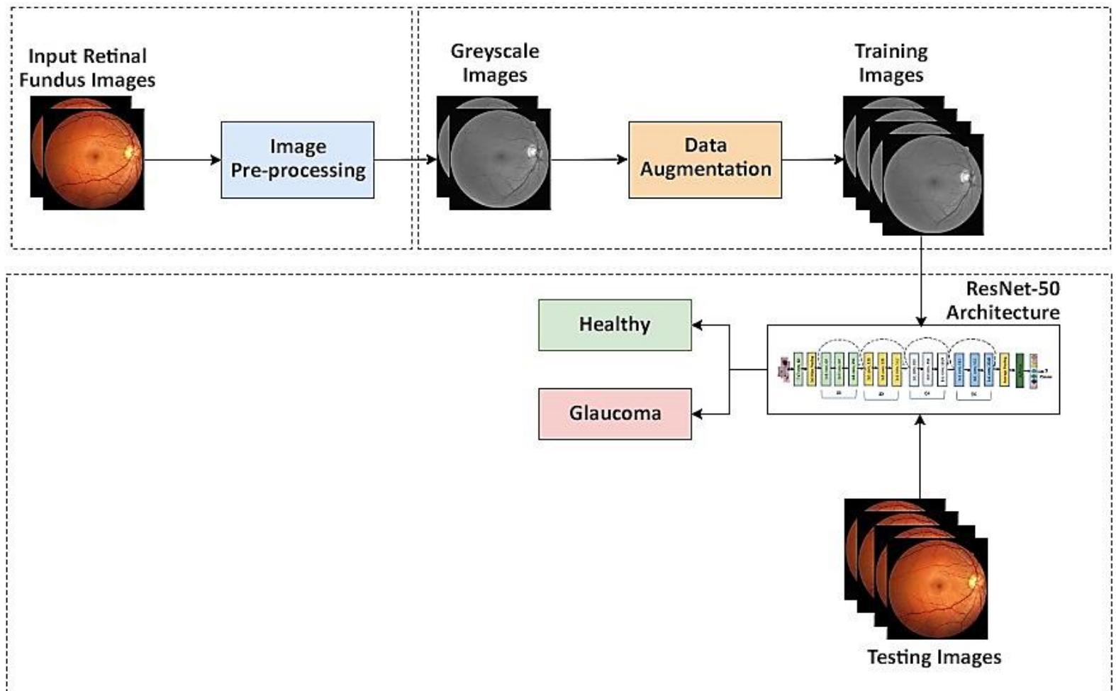 Flow diagram of the proposed model for glaucoma detection.