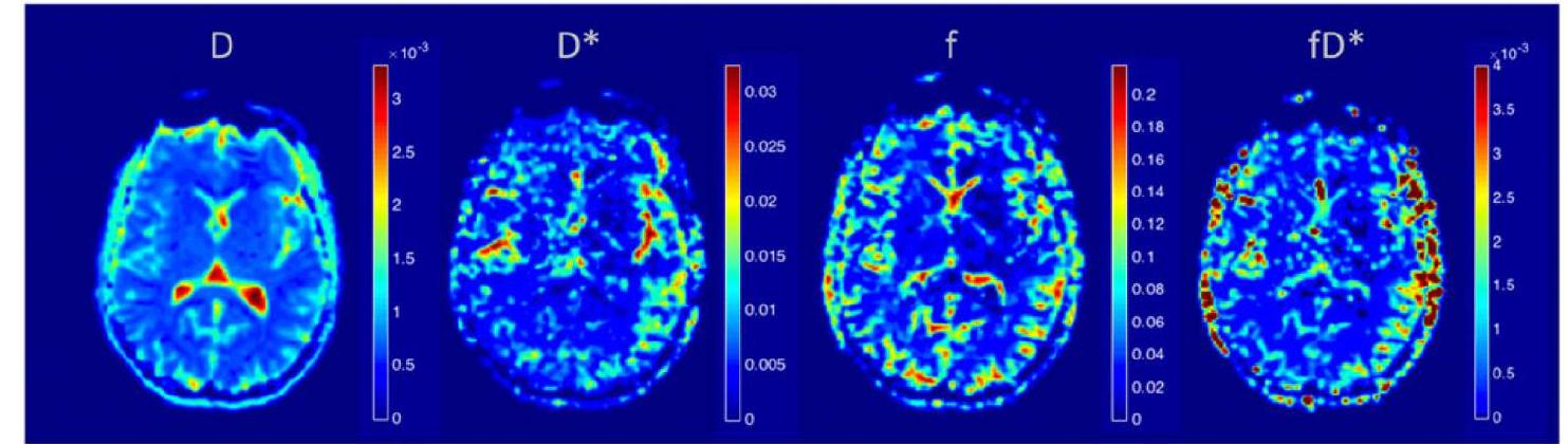 Figure 25 - Anatomical Modeling of Cerebral Microvascular