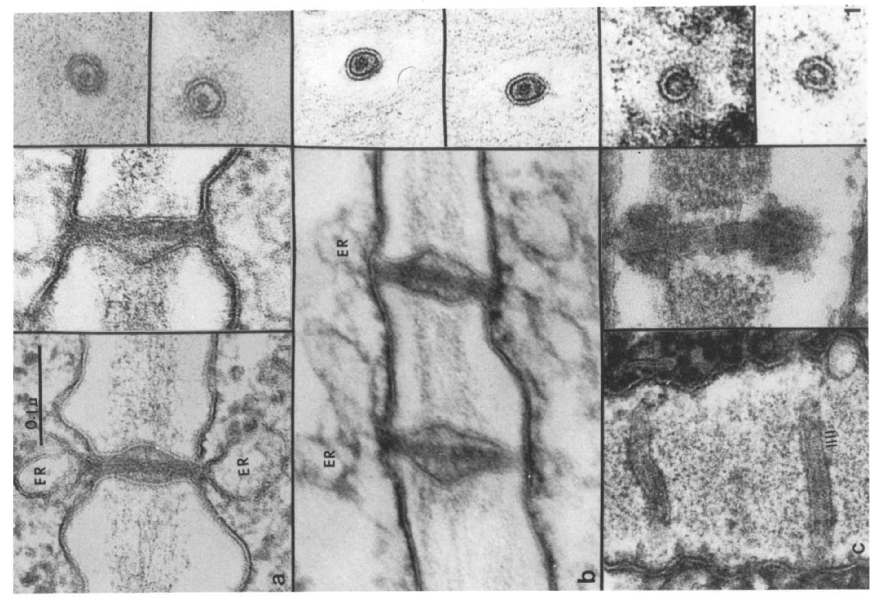 Figure 1 - The structure of plasmodesmata as revealed by