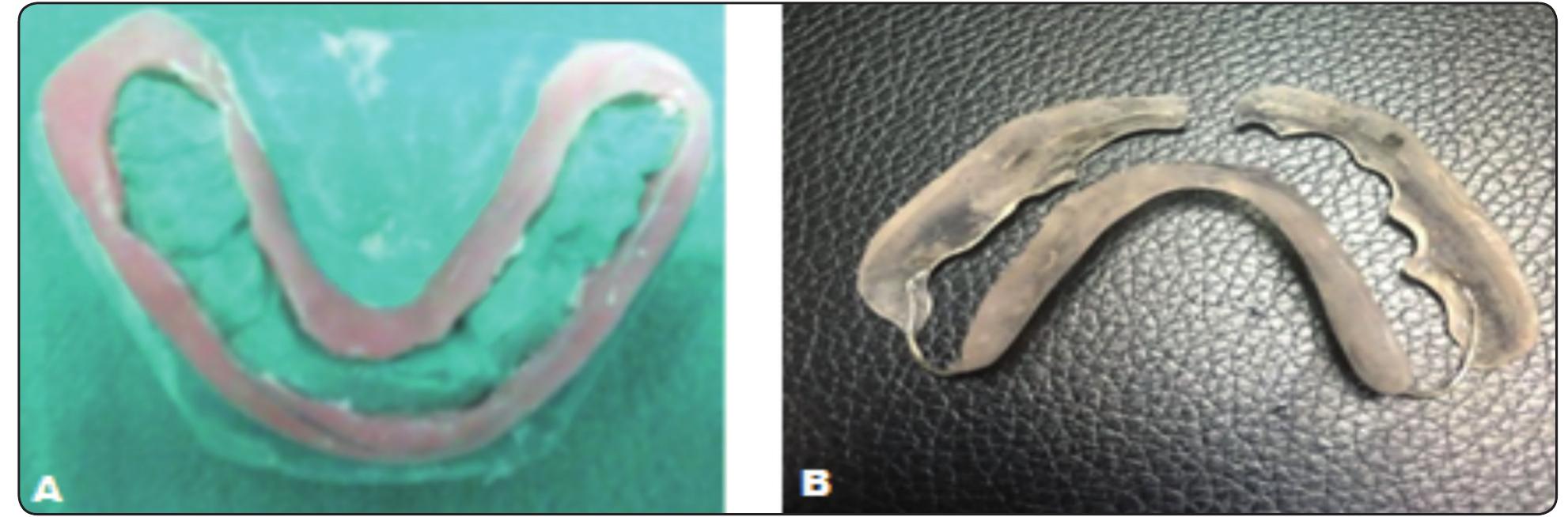 (2) a) open cap splint (b) split acrylic cap splint