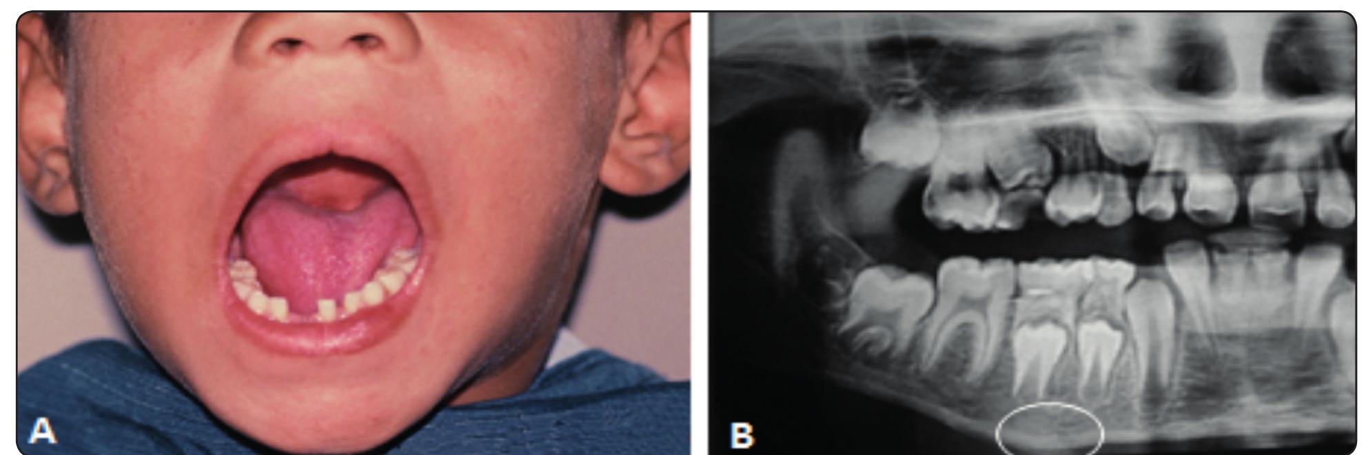 (4) a) postoperative intraoral clinical photograph showing