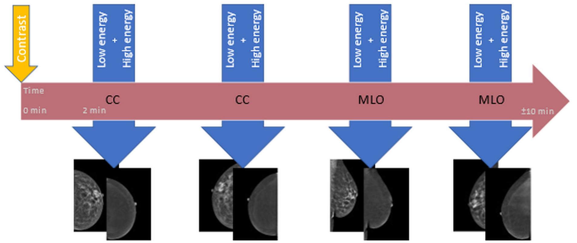 Diagram of image acquisition for contrast-enhanced