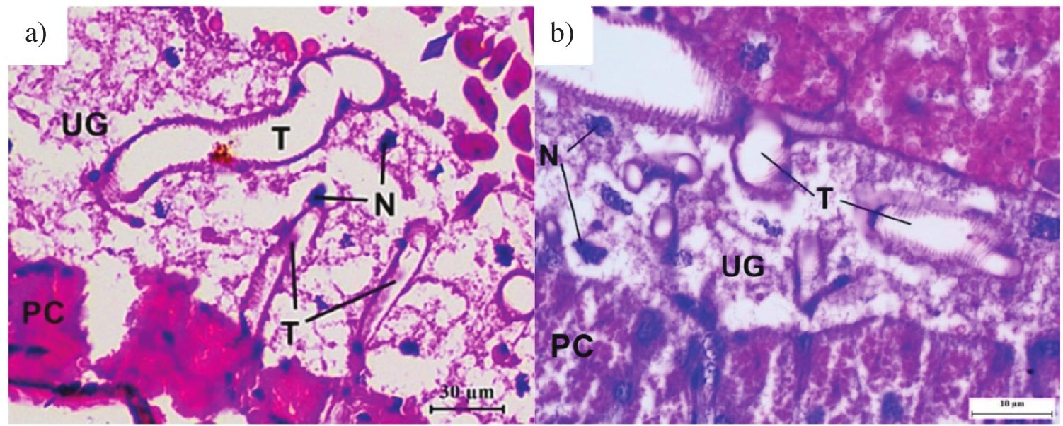 Transverse section of the reflector layer. a) male light