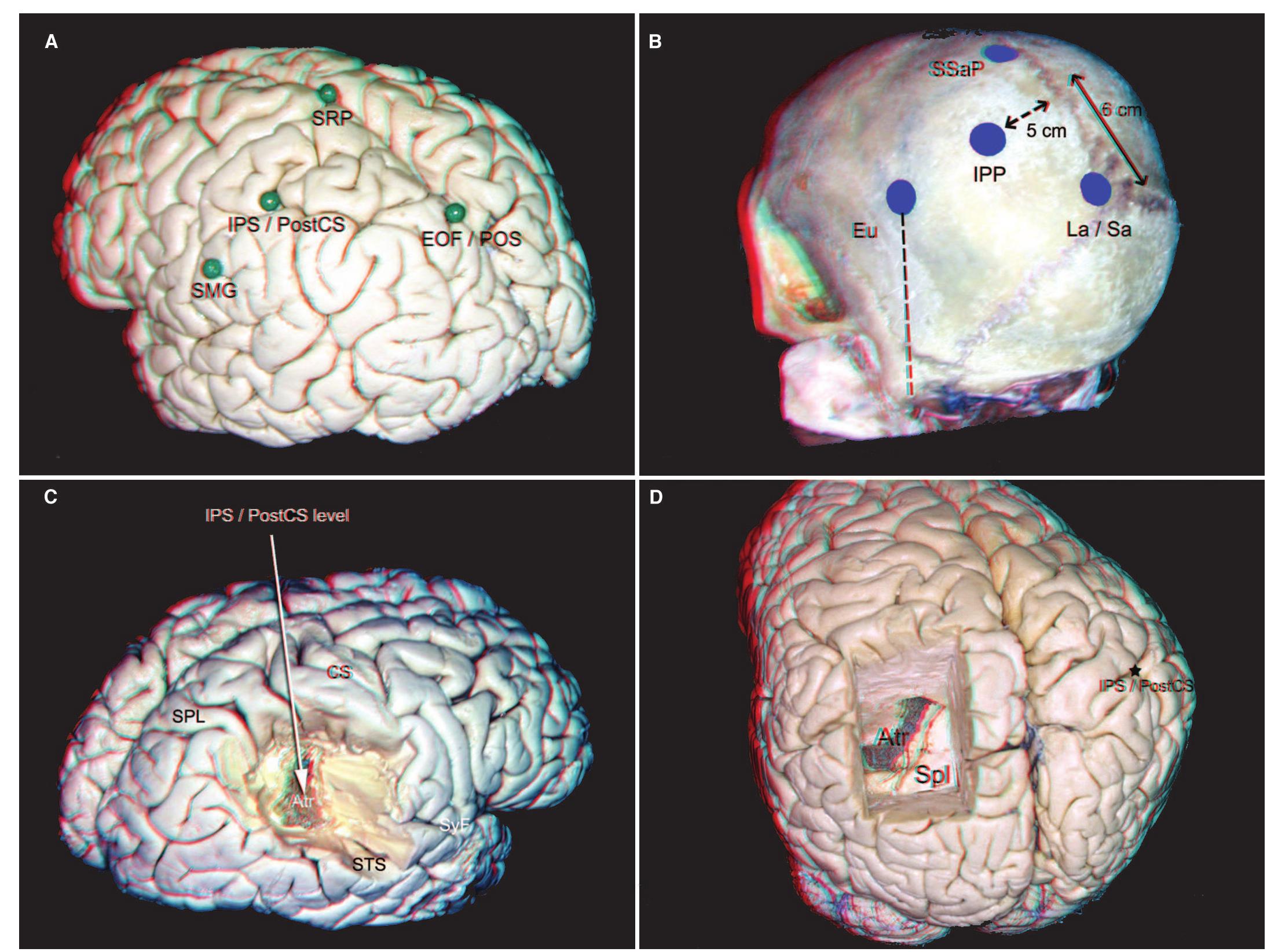 Parietal key points. a, the parietal sulci and gyri