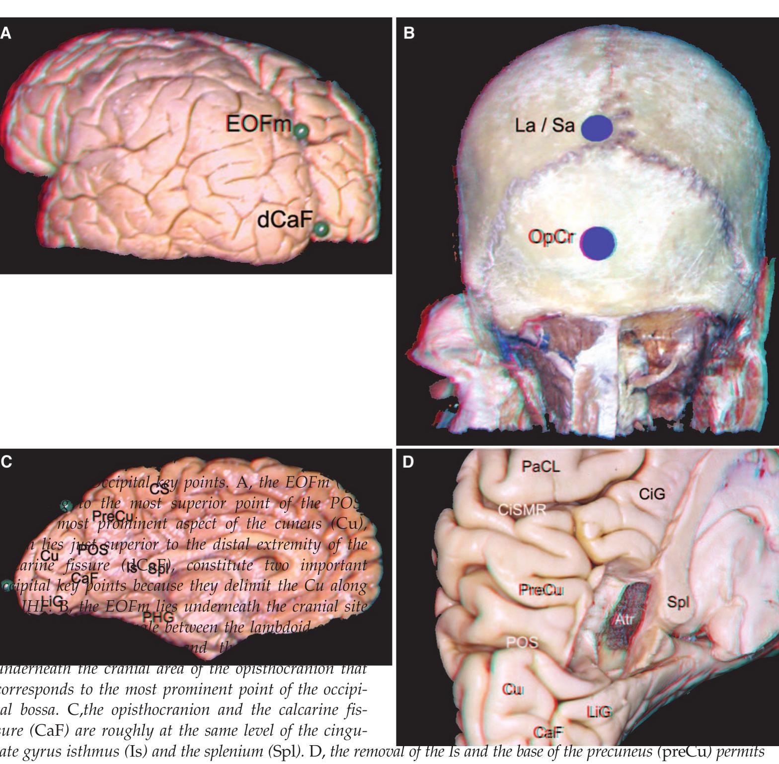 Figure 18 - Surgical Anatomy of Microneurosurgical Sulcal