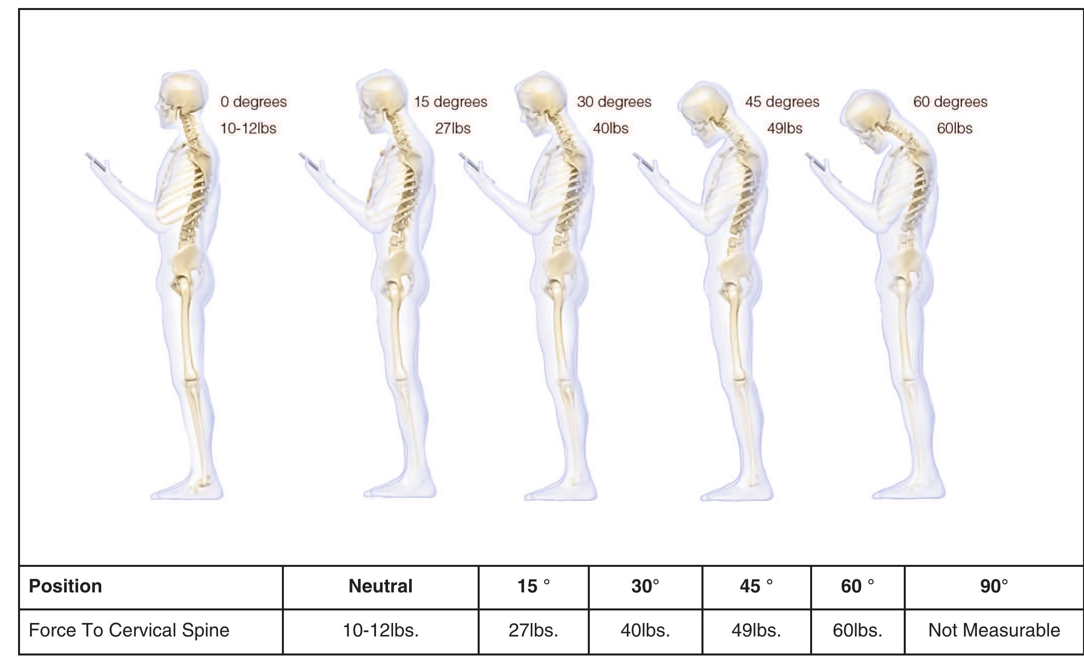(PDF) Assessment of stresses in the cervical spine caused by posture ...