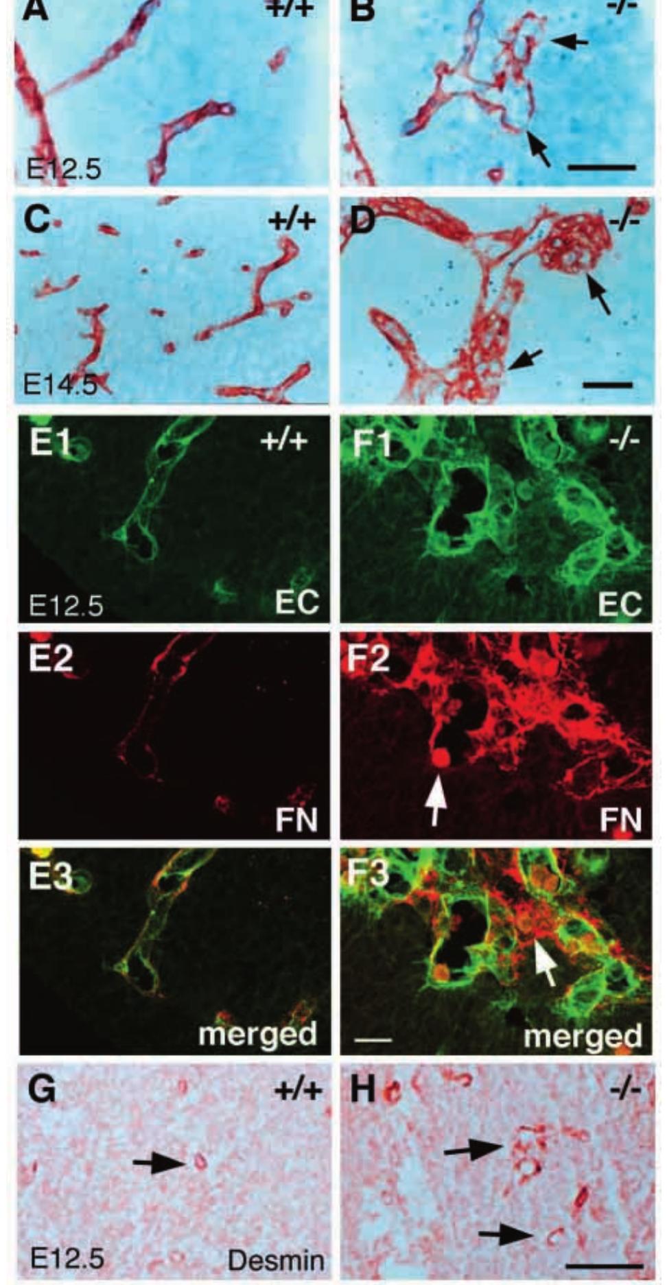 Abnormal brain capillary morphologies in class b integrin