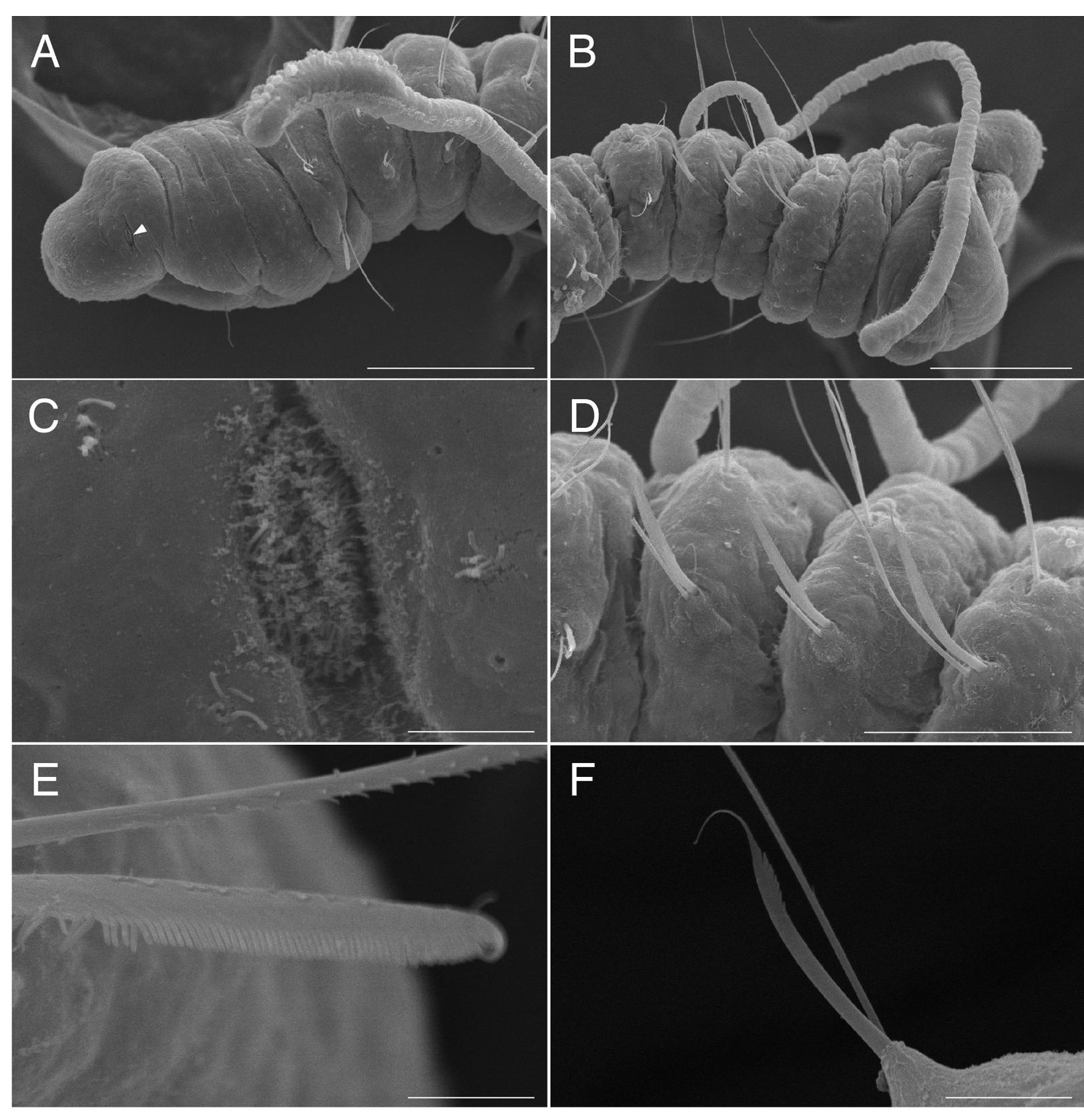 Scanning electron micrographs of raphidrilus misakiensis sp.