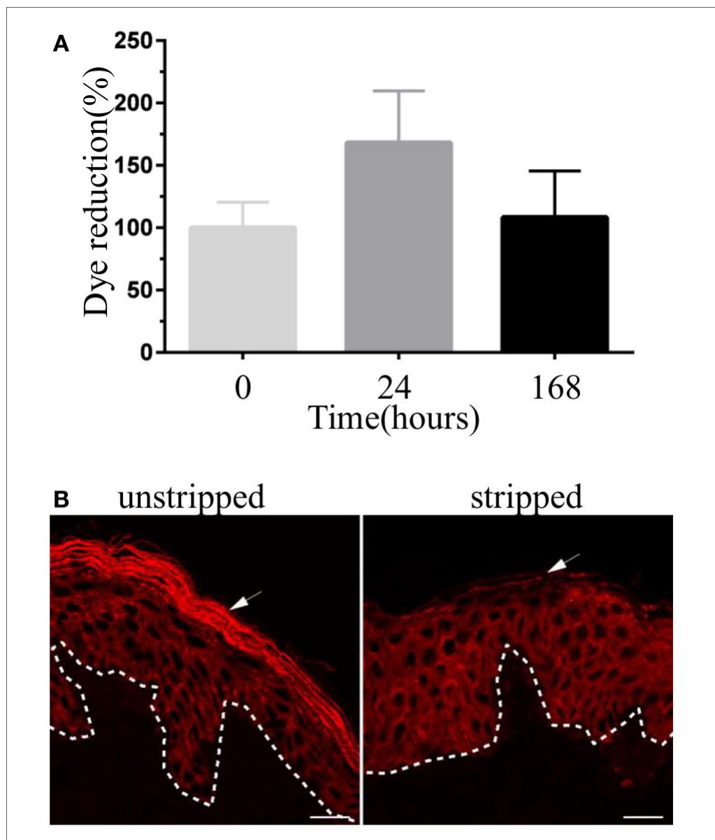 | validation of human skin explant model. (a) the viability