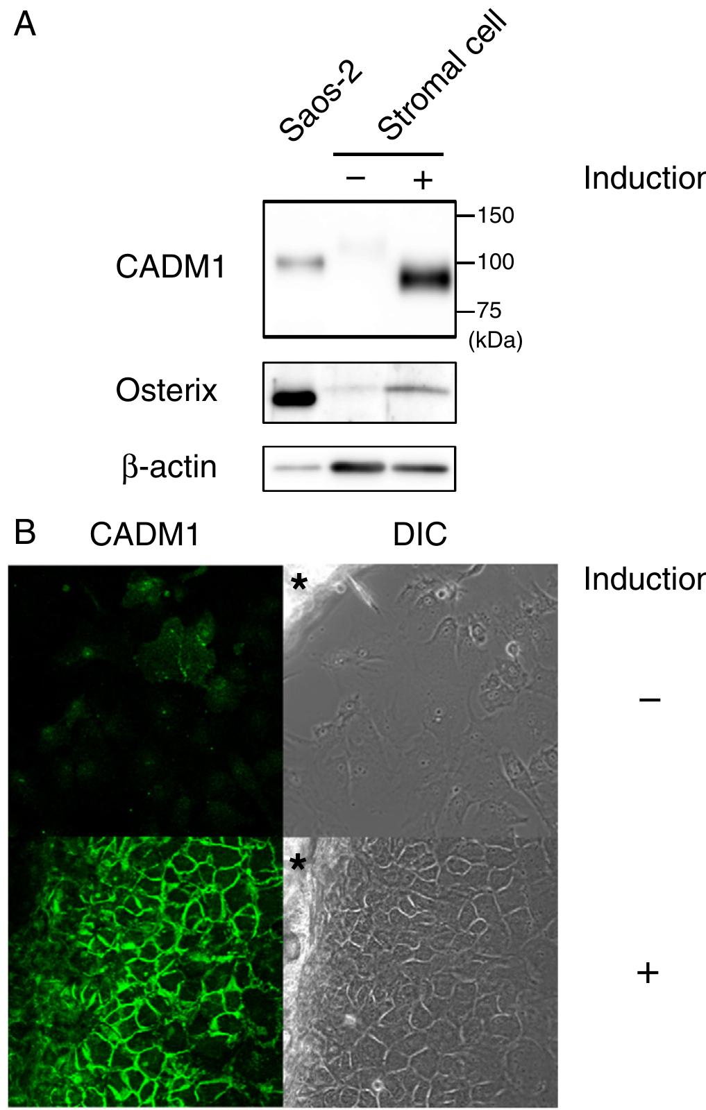 Expression of cadm1 in calvarial stromal cells. mouse