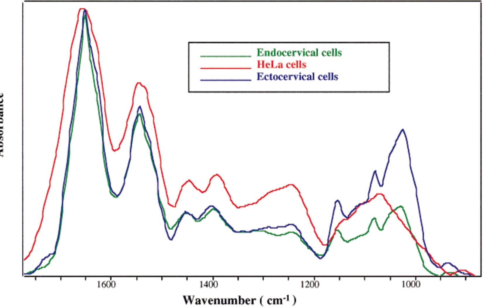 Infrared spectra of normal ectocervical cells, normal