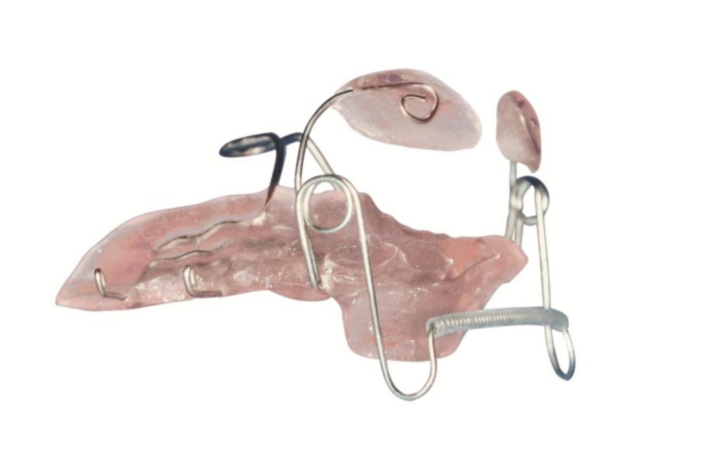 Figure 3 - Treatment of Skeletal Class III Malocclusion