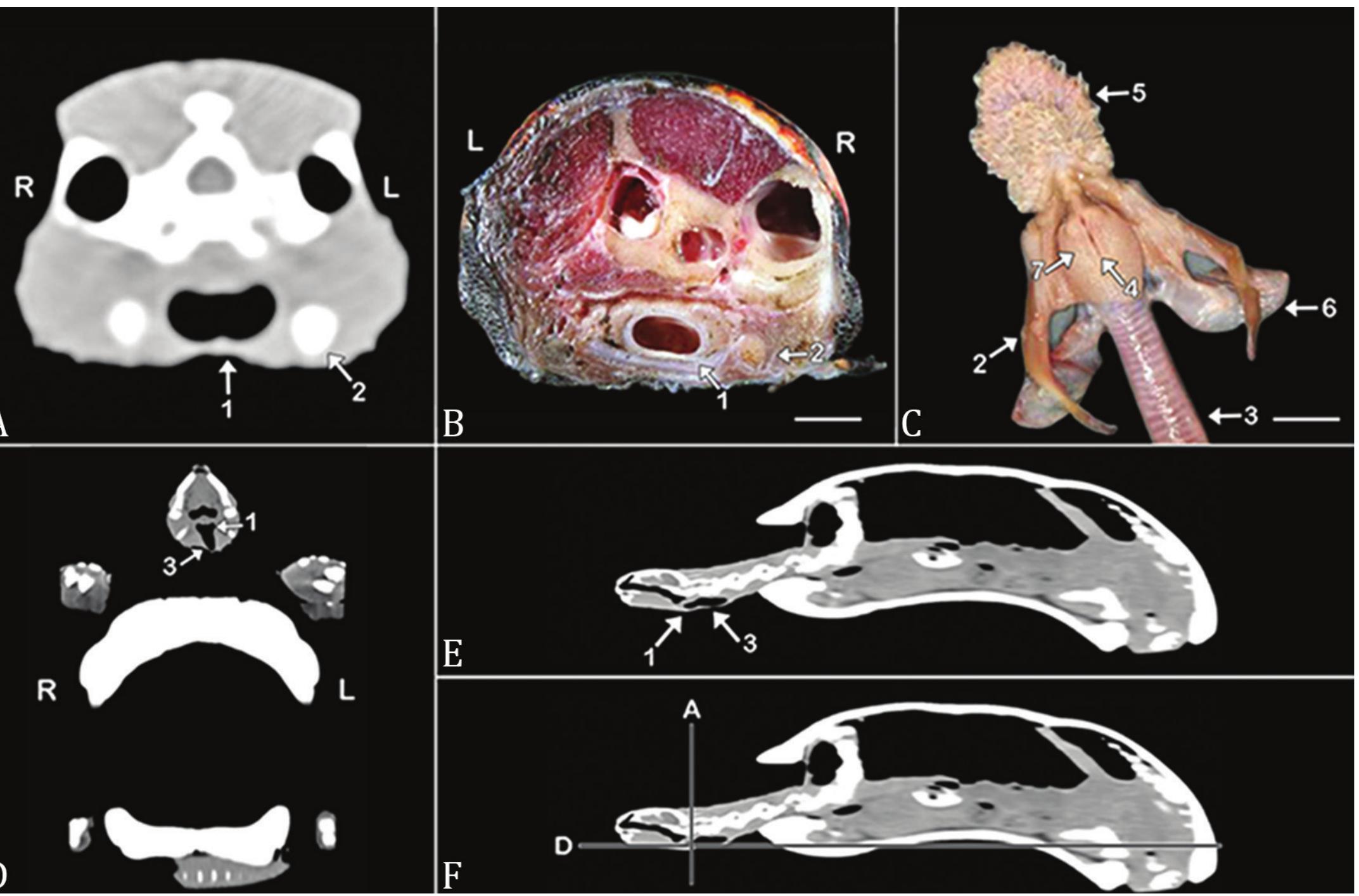 Tomographic and anatomical images of the glottis in the