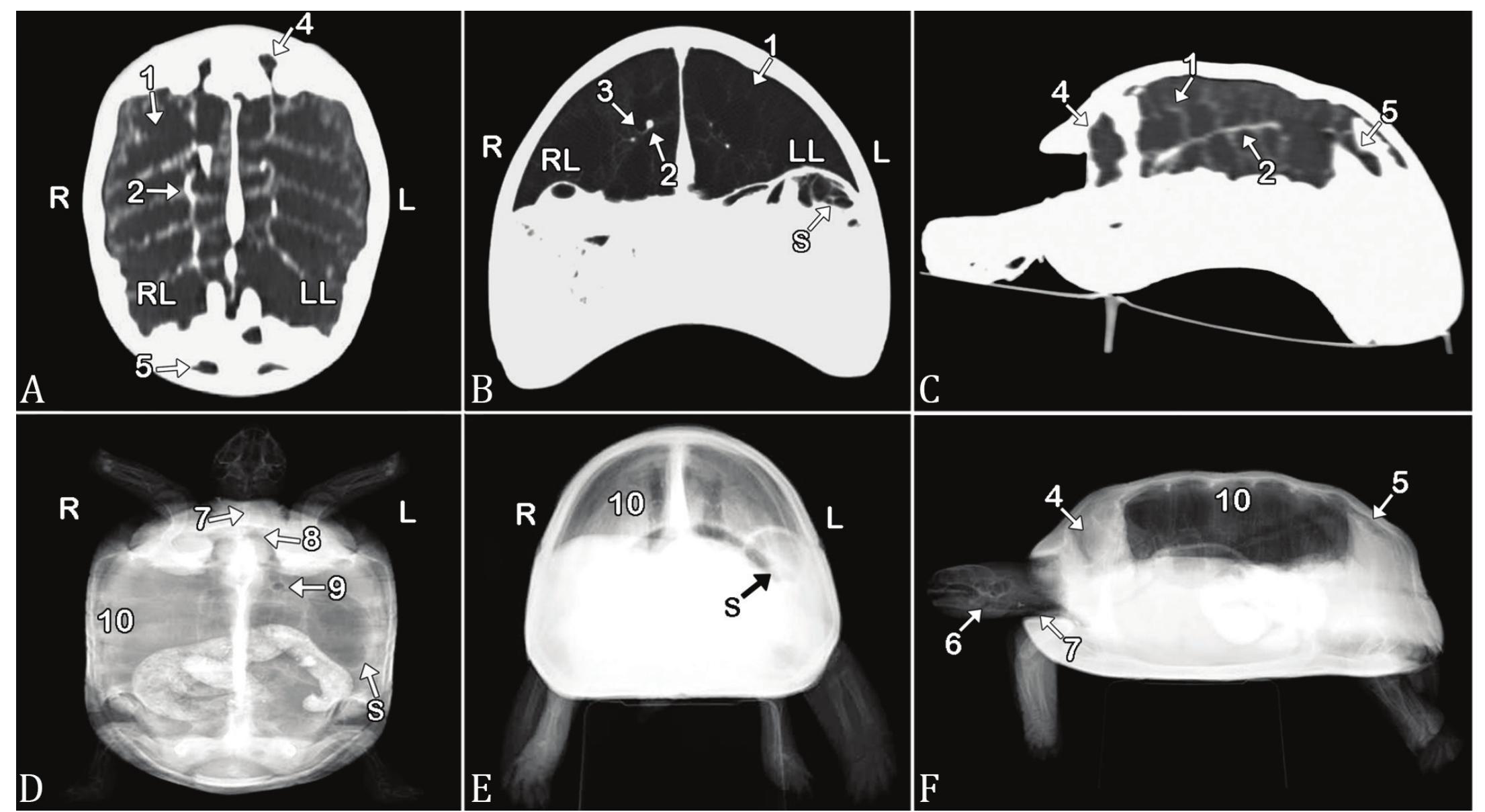 Ig.2. tomographic and radiographic images of the lungs in