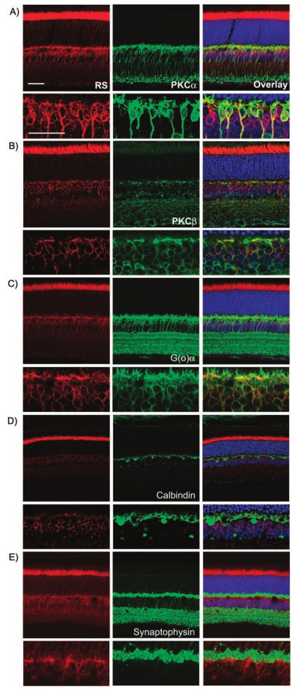Ficuree 6. confocal images of double-labeled retinal bipolar