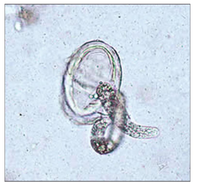 Larva of ascaris lumbricoides hatching from an egg [6]