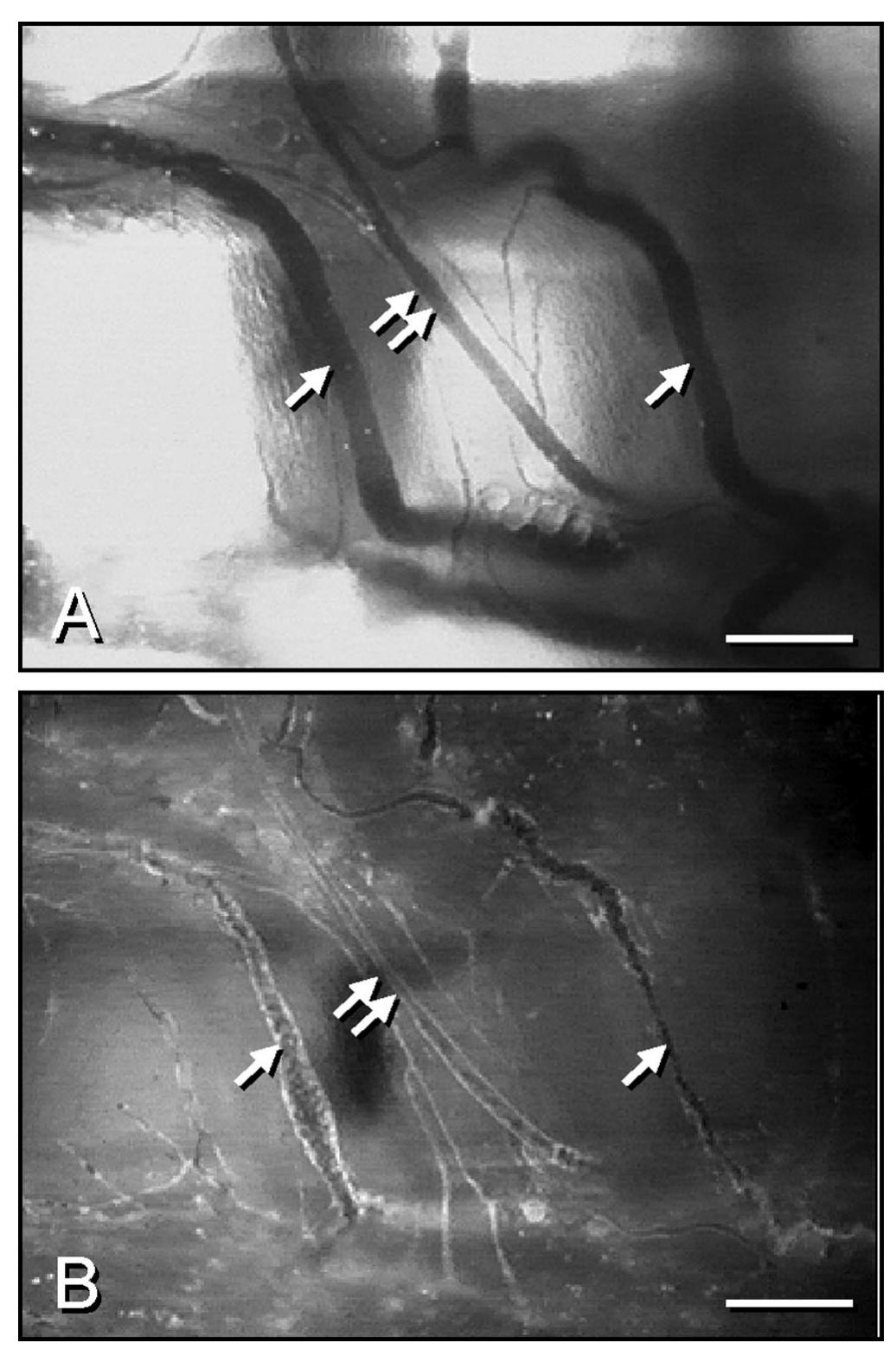 Figure 2 - from Improvement of Vascularization of PLGA
