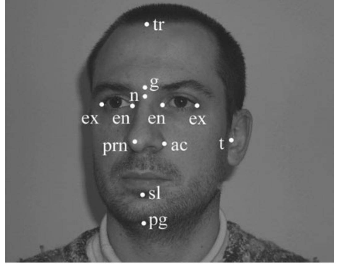Fic. 1. standard anthropometric landmarks. according to