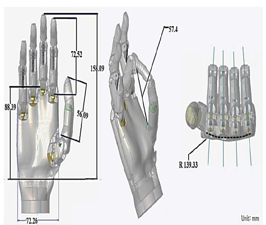 Palm up rigid design. fig. 8. complete prosthetic hand