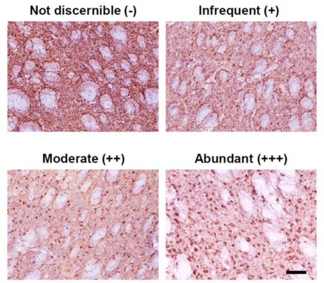 22: images showing different types of alpha-synuclein