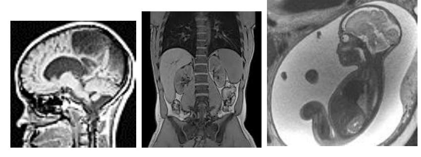 Mri sample images (mri1,mri2,mri3)