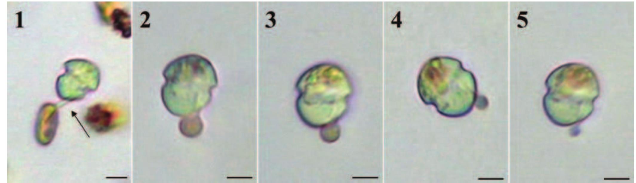 Figure 1 - from Feeding by the Pfiesteria-Like Heterotrophic