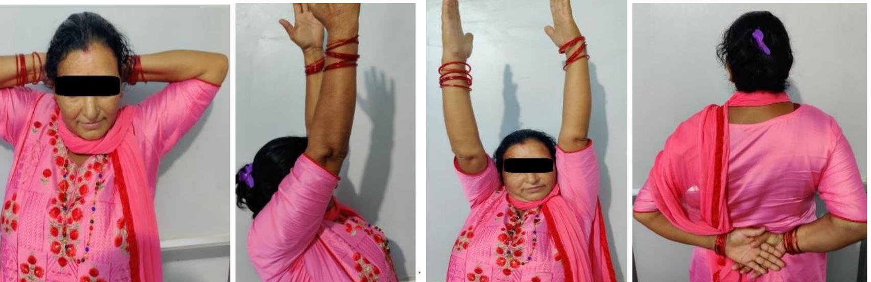 Shoulder and elbow range of motion in a 35-year-old female