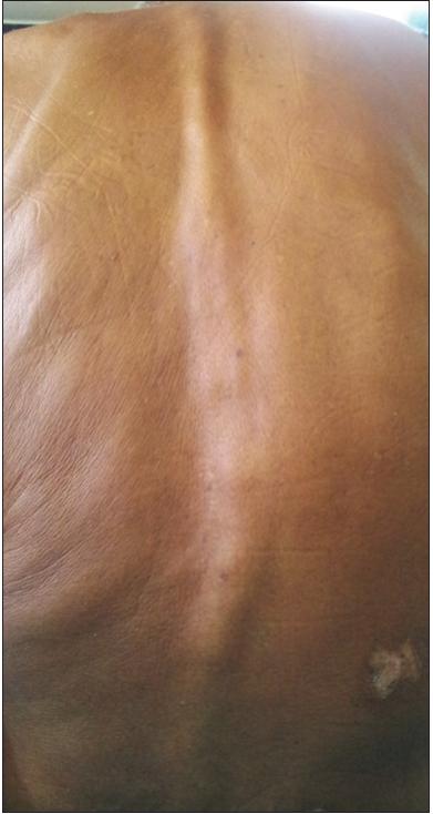 |: patient showing lumbar scoliosis the first 10 blocks by