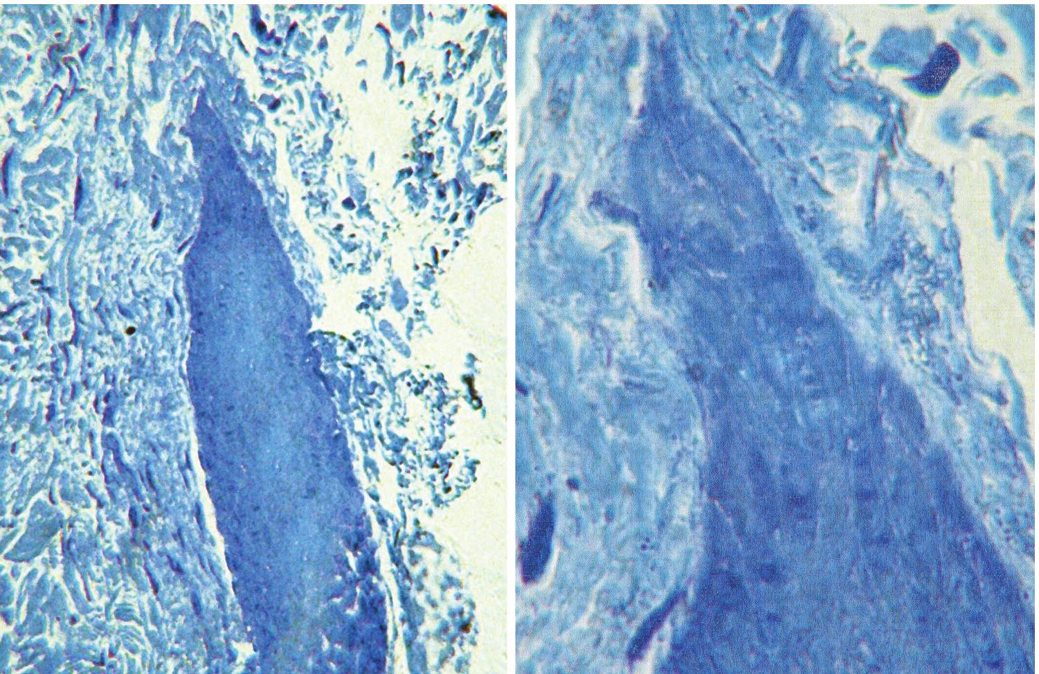 Fic. 1. light microscopic examination of human skin biopsy
