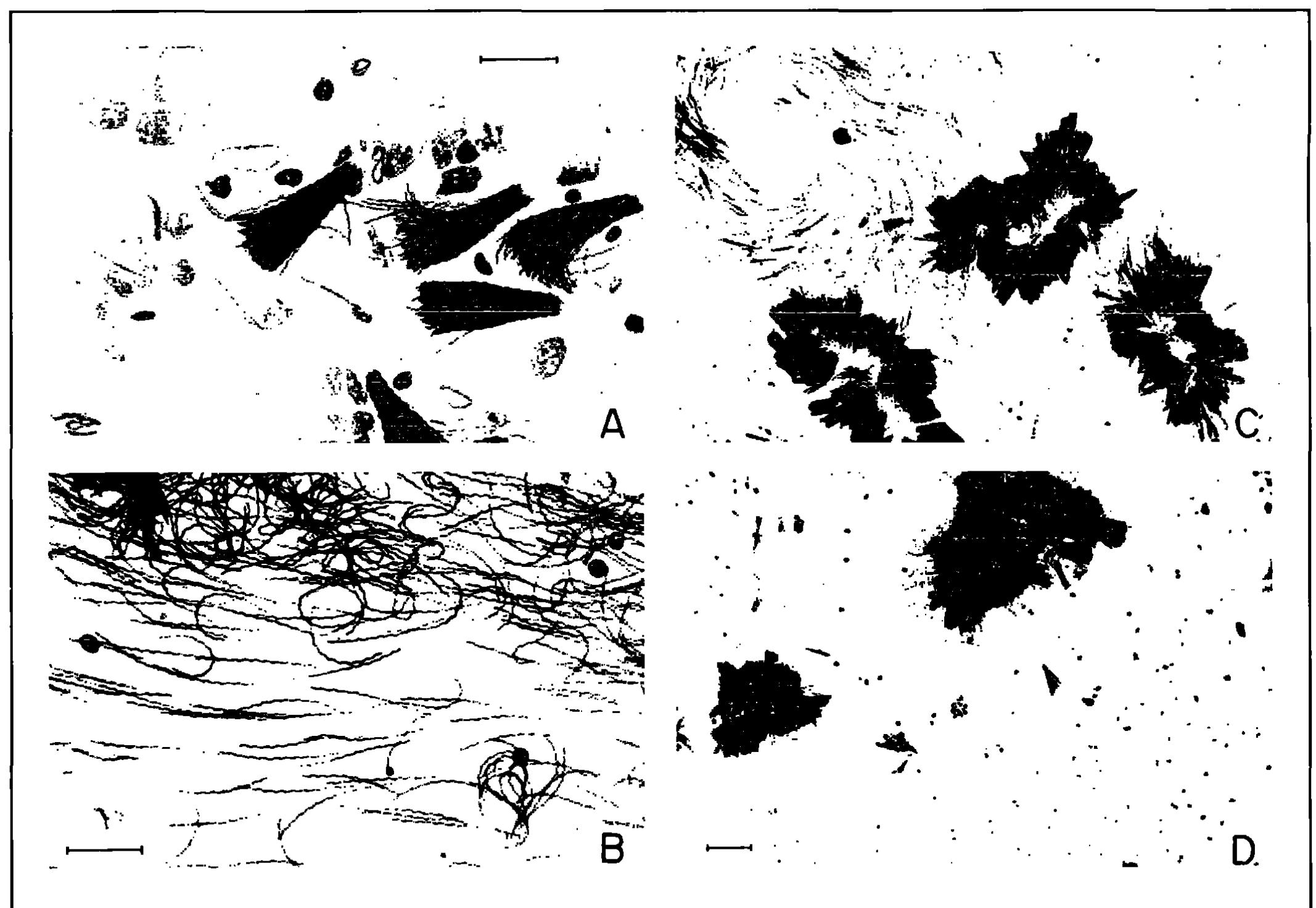 A spermatozoa in smears of reproductive organs of the school
