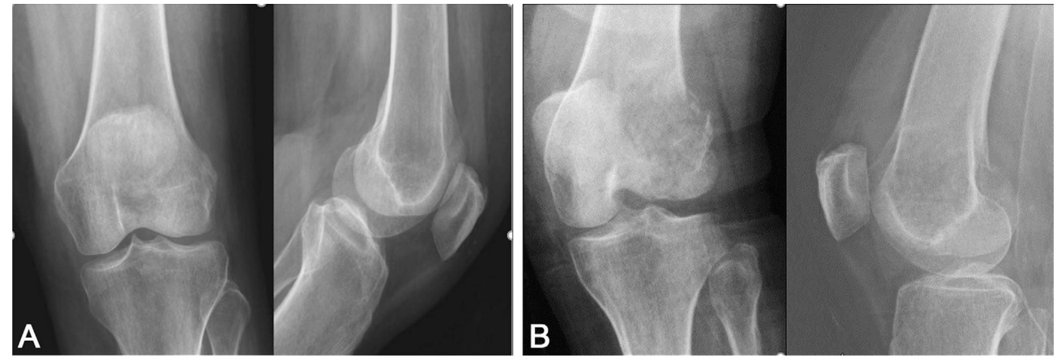 S. 2-a and 2-b anterior-posterior (ap) and lateral
