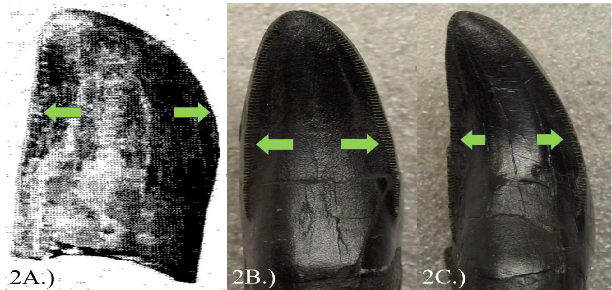 A comparison of the posterior/lingual/distal views of 2a.)
