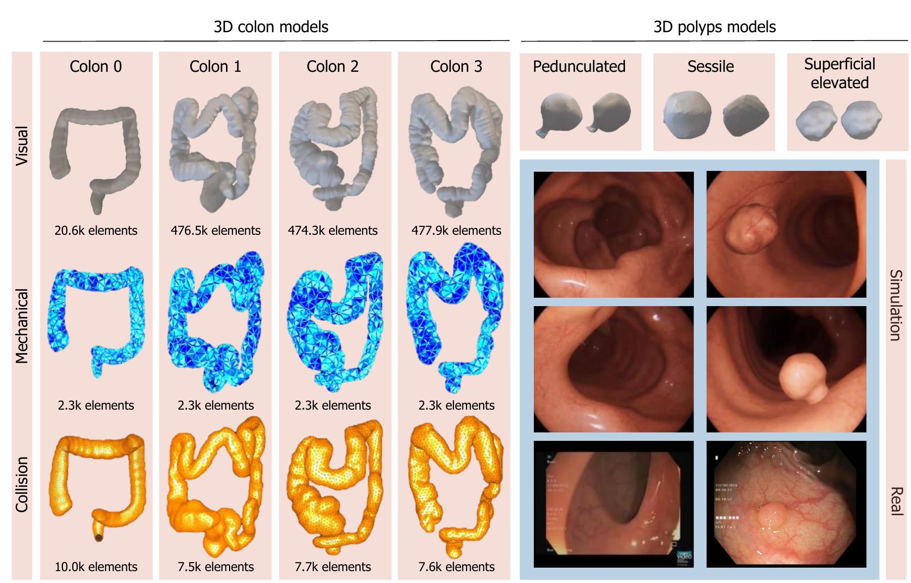 Four 3d colon models and three types of polyps models