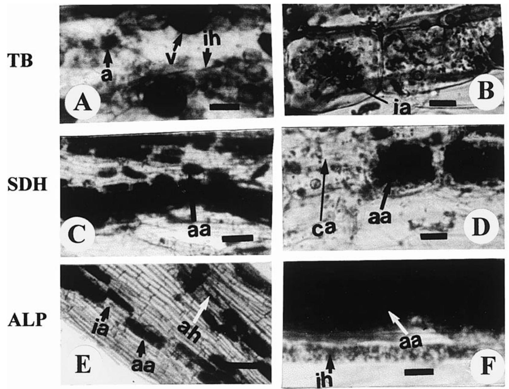 Root tissues of soybean plants infected by arbuscular