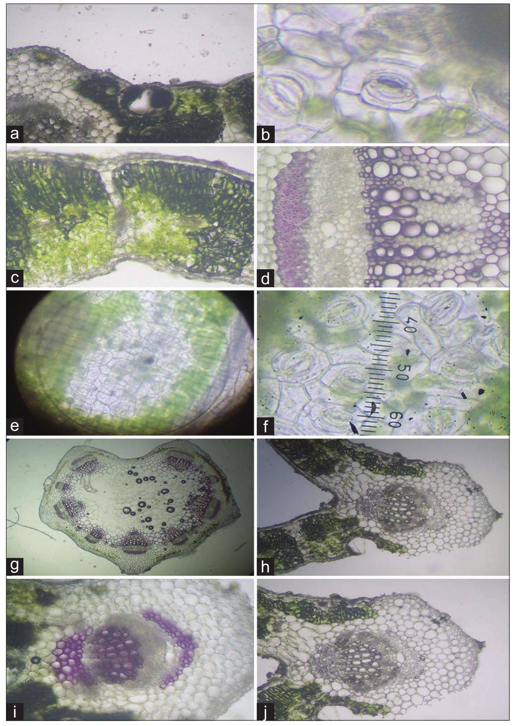 Transverse section of leaf (bakuchi). (a) epidermal cell