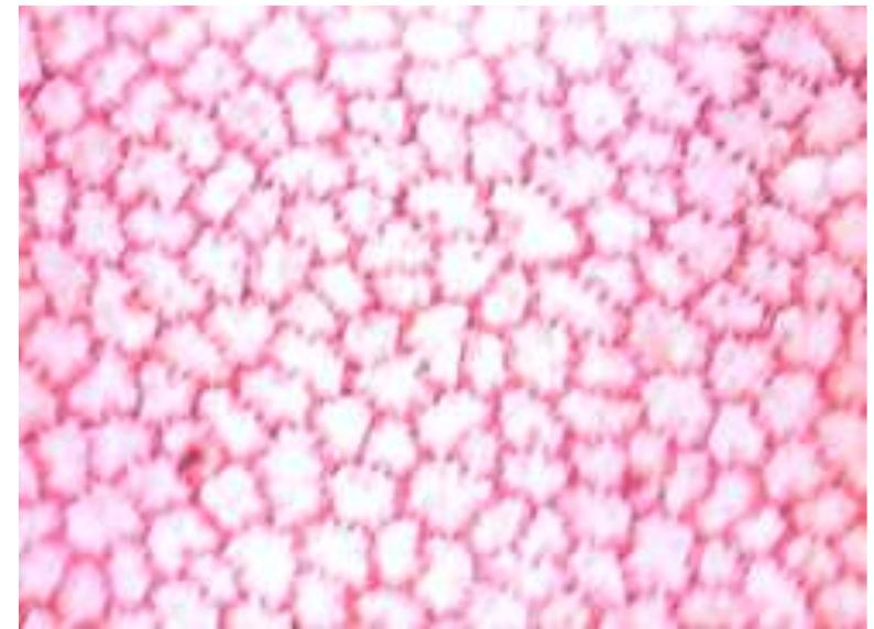 The epidermal cell shape is wavy / irregular in both