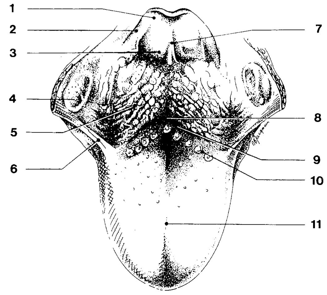 Clinical anatomy of the tongue, dorsal aspect (1 epiglottis;