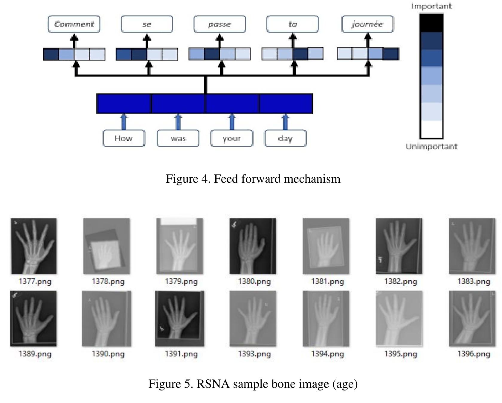 Illustrates the samples of rsna bone age dataset's fourth
