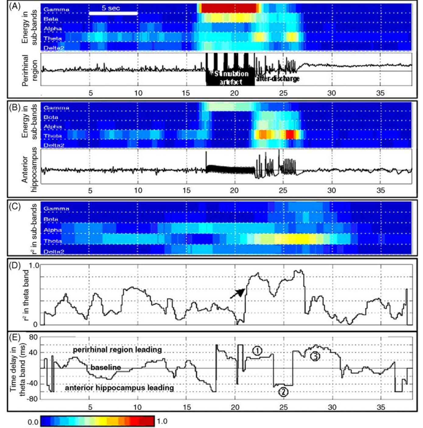 (a) bottom: depth-eeg signal recorded from the perirhinal