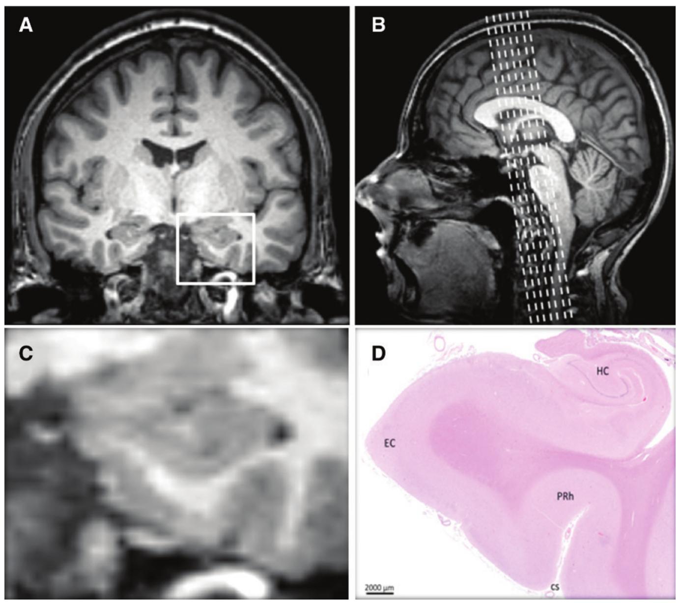 The entorhinal cortex. a, coronal and, b, sagittal