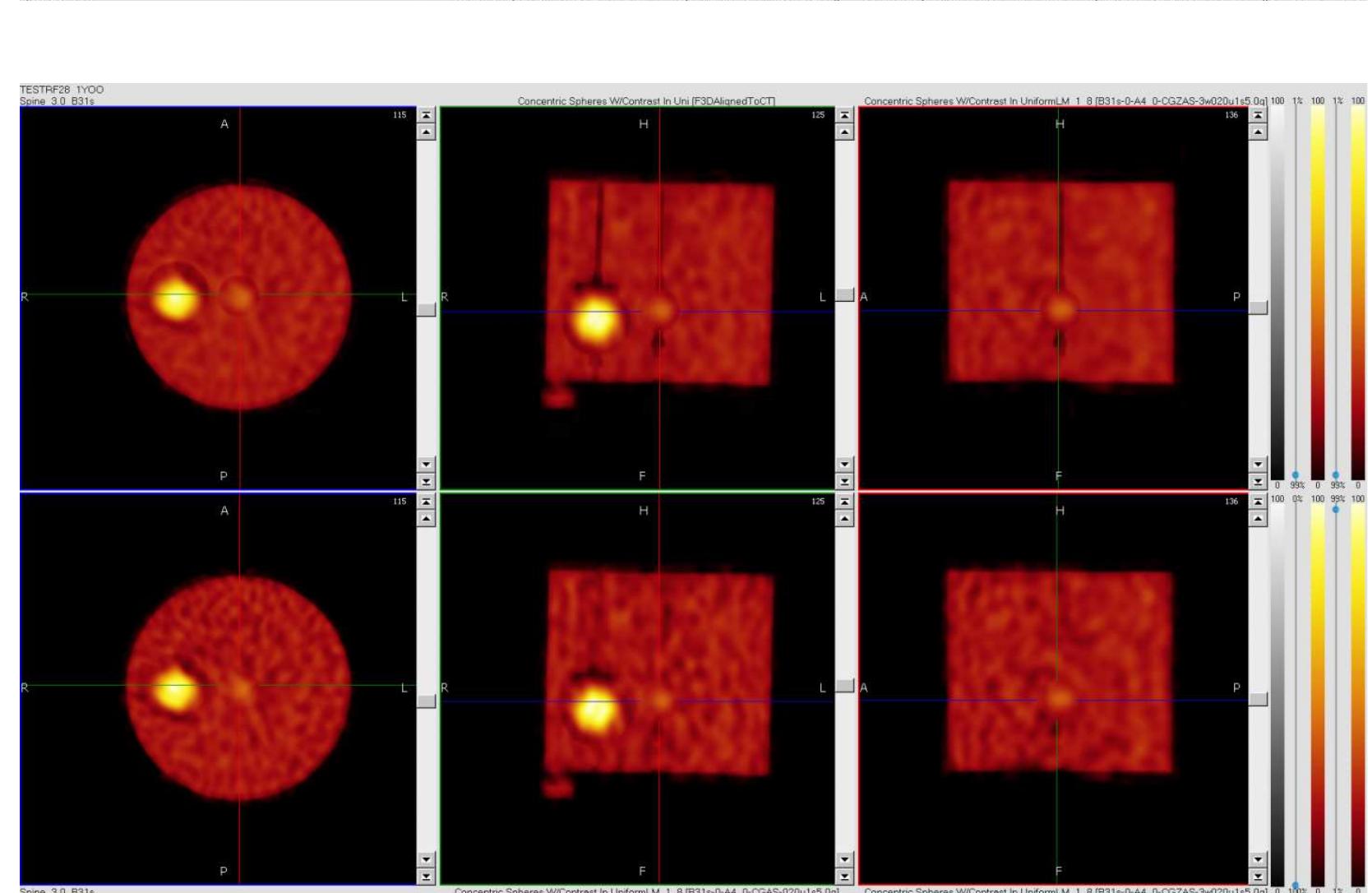 Concentric spheres of 2 different sizes inside a cylinder