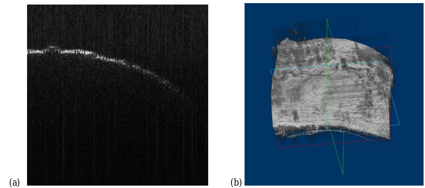 Examples of oct images of teeth surfaces: (a) b-scan, (b)