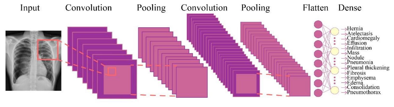 A typical convolutional neural network structure for