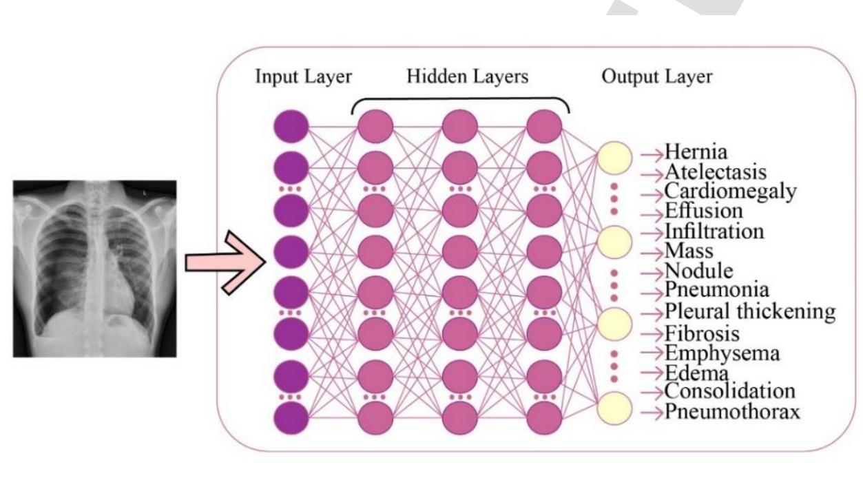 Multilayer perceptron (mlp) neural network with three hidden