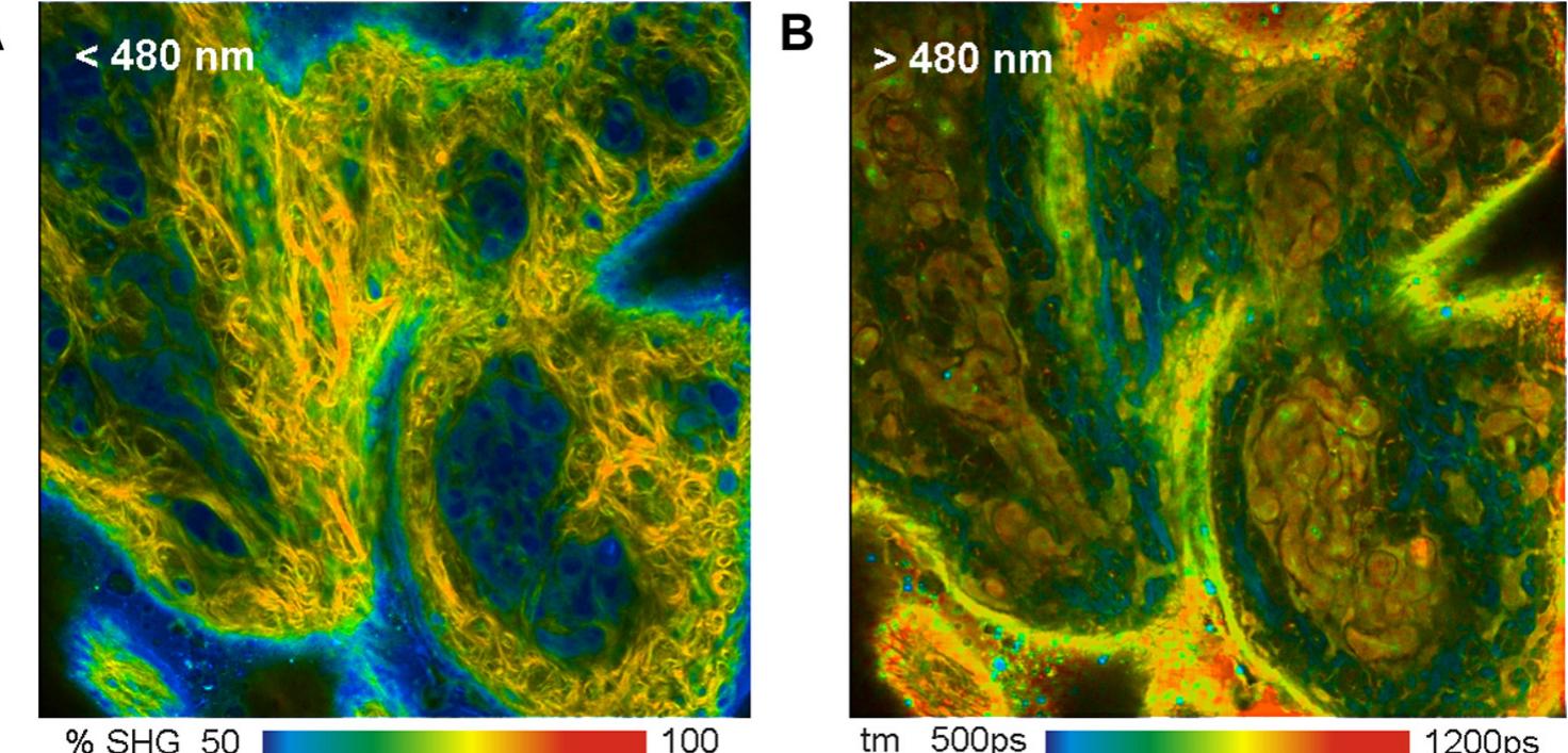 Two-photon flim of pig skin. images have been recorded with