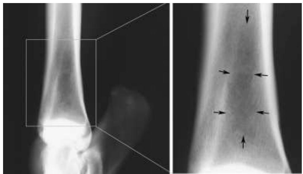 Fic. 1. lateromedial radiograph of the distal tibial