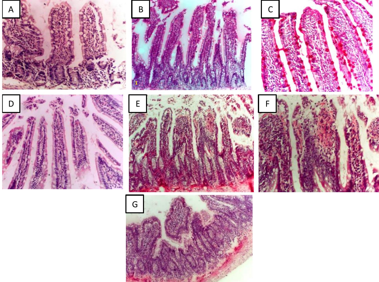 (5). histopathology photomicrographs of small intestine