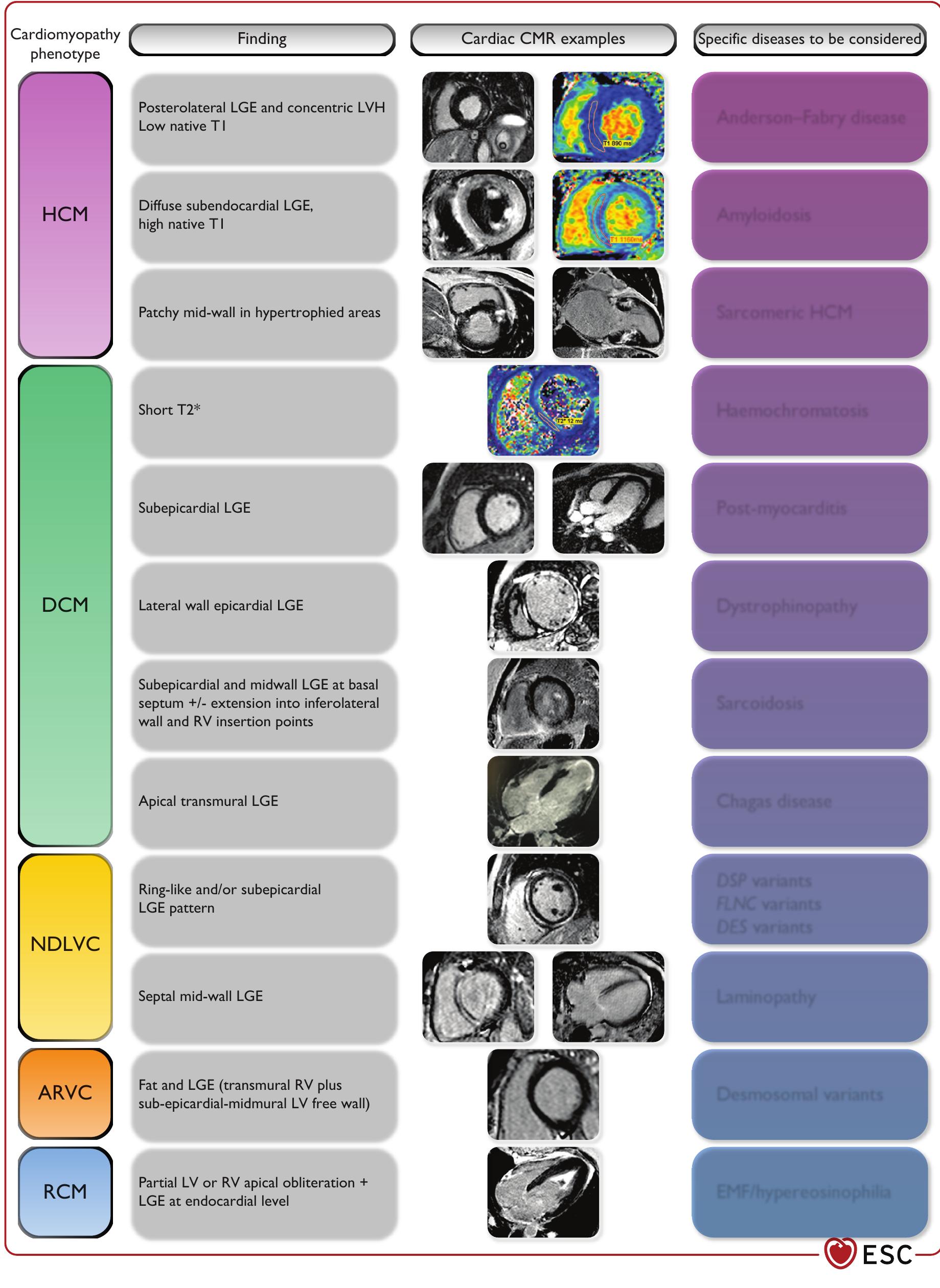 Examples of cardiac magnetic resonance imaging tissue