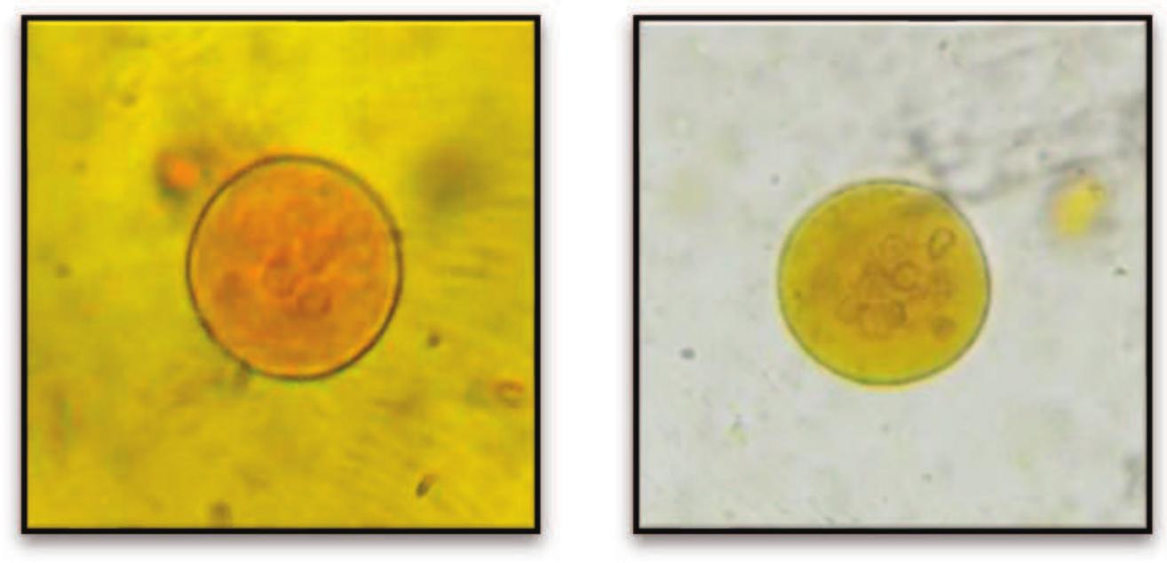 Actual photographs of amoeba cysts found in fecal samples.