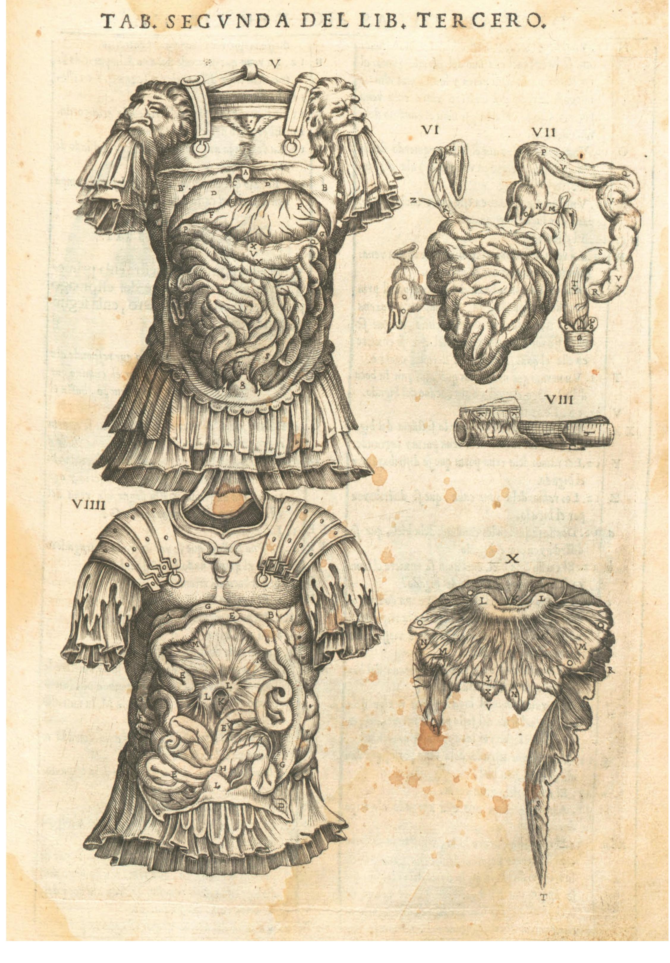Figure 1 - The Prince's Prosthetic Body: Orthopedic Armor